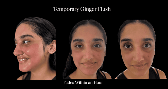 Ginger Flush Reaction: Why the Temporary Pink Tingling Happens and What ...